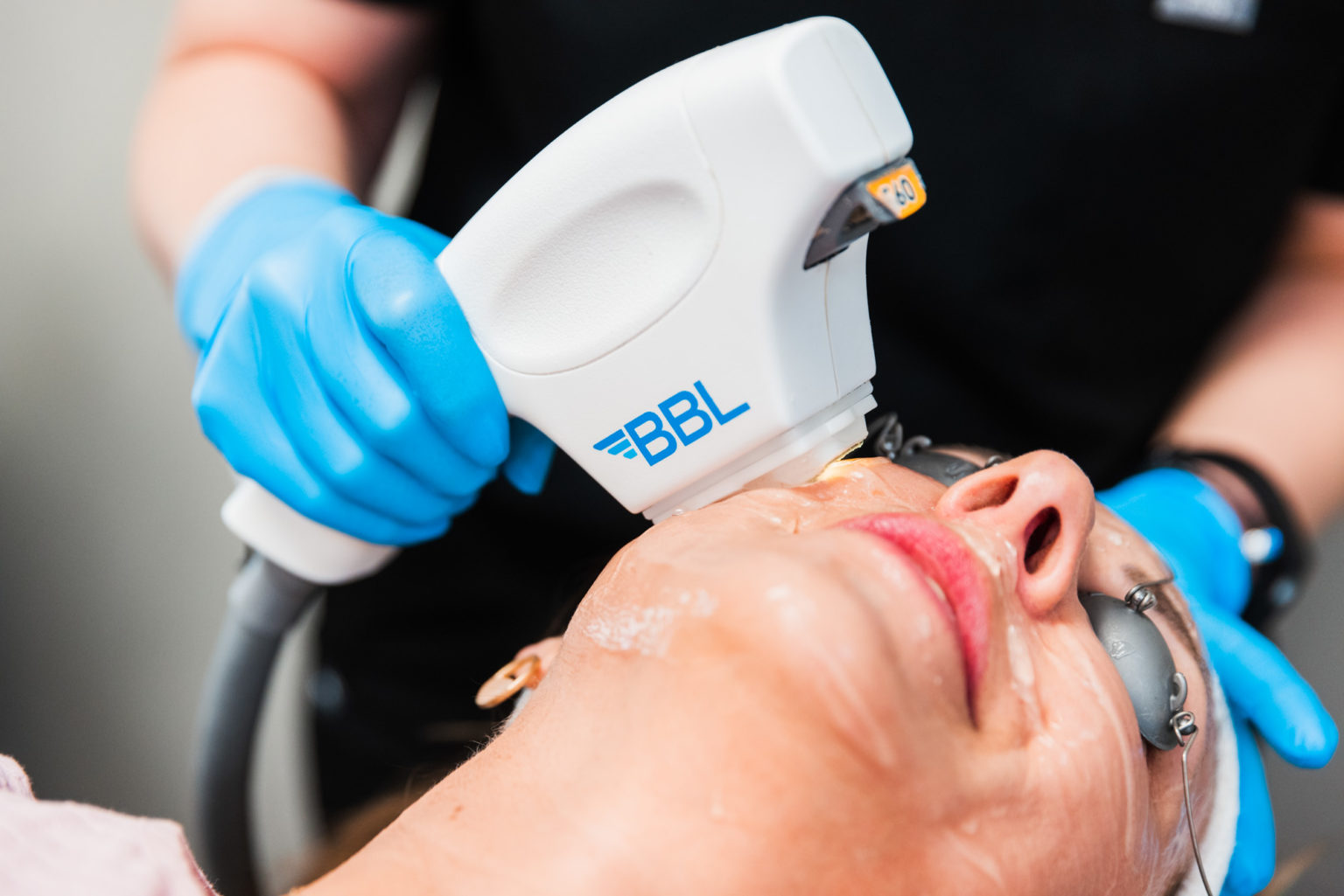 BBL Heroic Chicago | Vernon Hills, IL | RL Center for Cosmetic Surgery ...